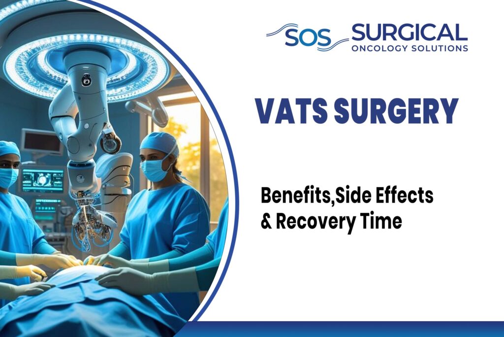 VATS Surgery: benefits,side effects & recovery time