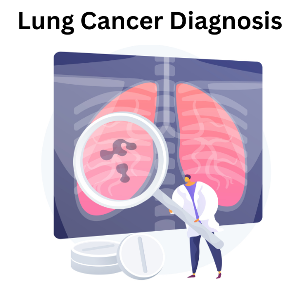 Lung Cancer: Causes, Symptoms & Effective Treatment Options